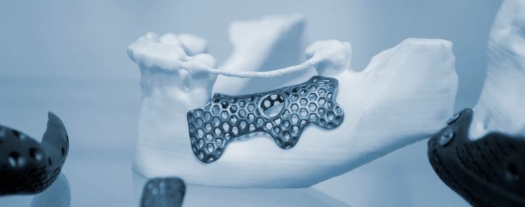 What Is Titanium Used For? - NeoNickel